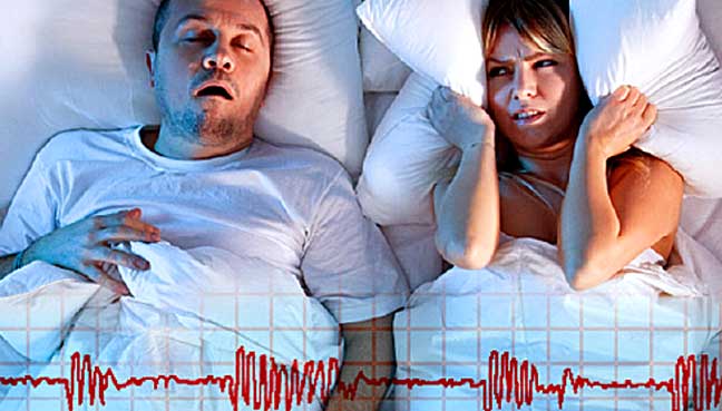 Improving sleep apnea diagnosis could delay Alzheimer’s disease | Free ...