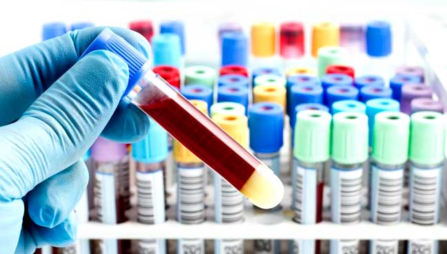 Simple blood tests can help detect, target cancer | FMT