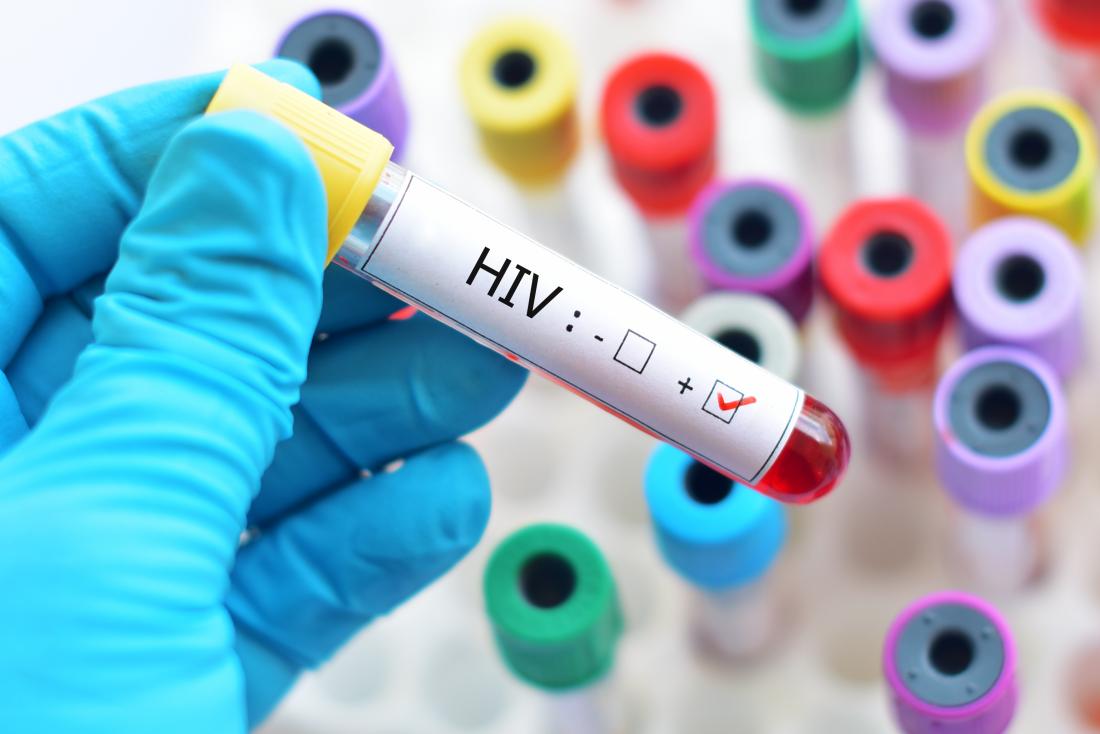 HIV: Apa remaja perlu ketahui implikasi dan cara elak | FMT