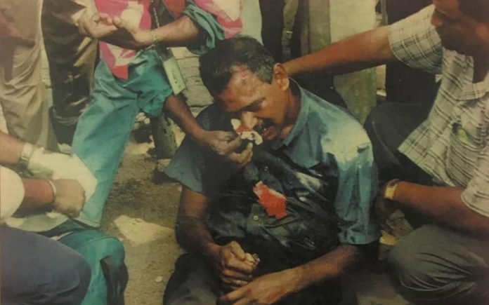 Newsman whose skull was cracked in 8 places in rail mishap | Free ...