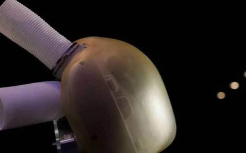 French group Carmat sells its first prosthetic heart | FMT