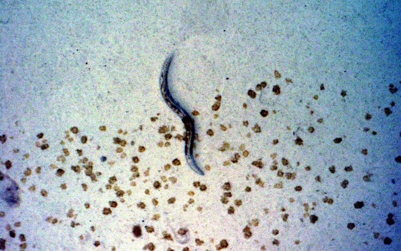 Japan uses tiny worms to sniff out cancer | Free Malaysia Today (FMT)