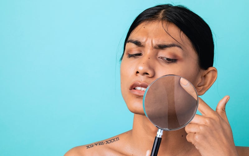 Psychodermatology: study of the mind-skin connection | FMT