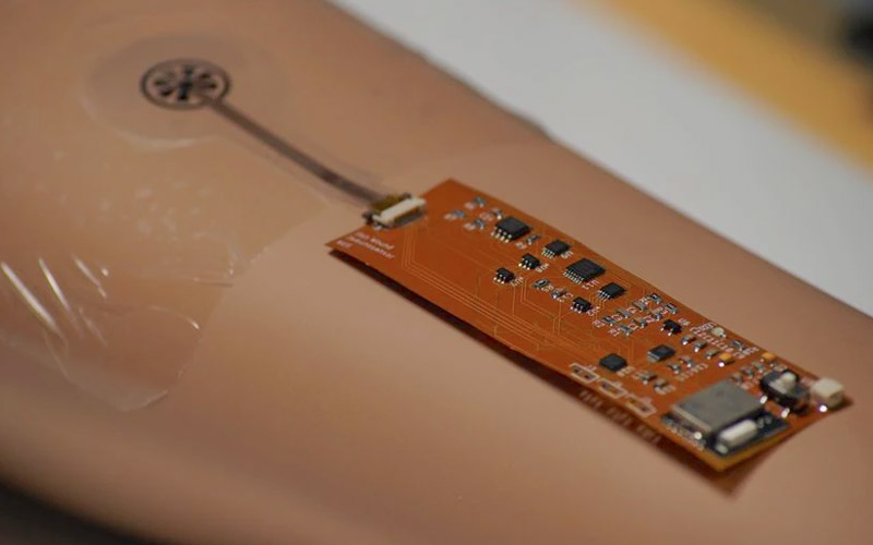 Singapore tests out ‘smart bandage’ for remote recovery | FMT