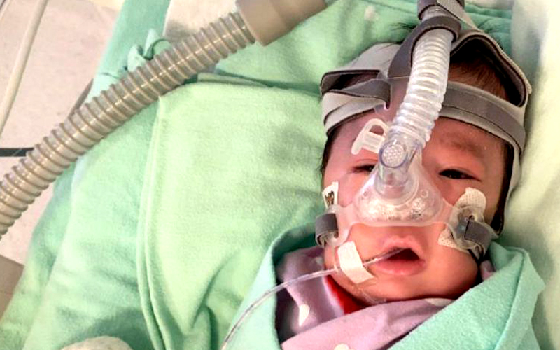 Baby diagnosed with generalised muscle weakness needs your help | FMT