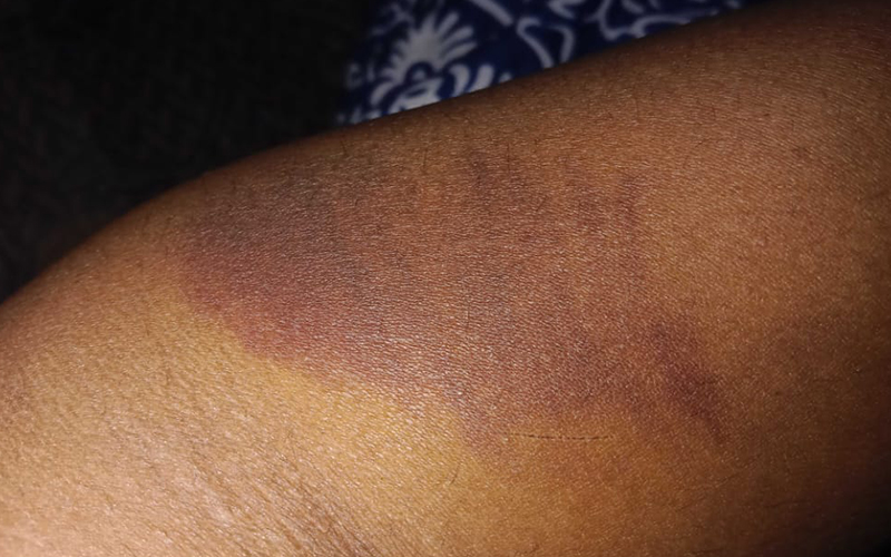 Rezeki dicari ‘neraka’ menanti, ibu tunggal rayu diselamatkan dari ...