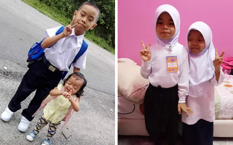 Living with a child with Noonan Syndrome | FMT