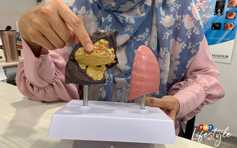 Identifying the silent killer called pneumonia | FMT