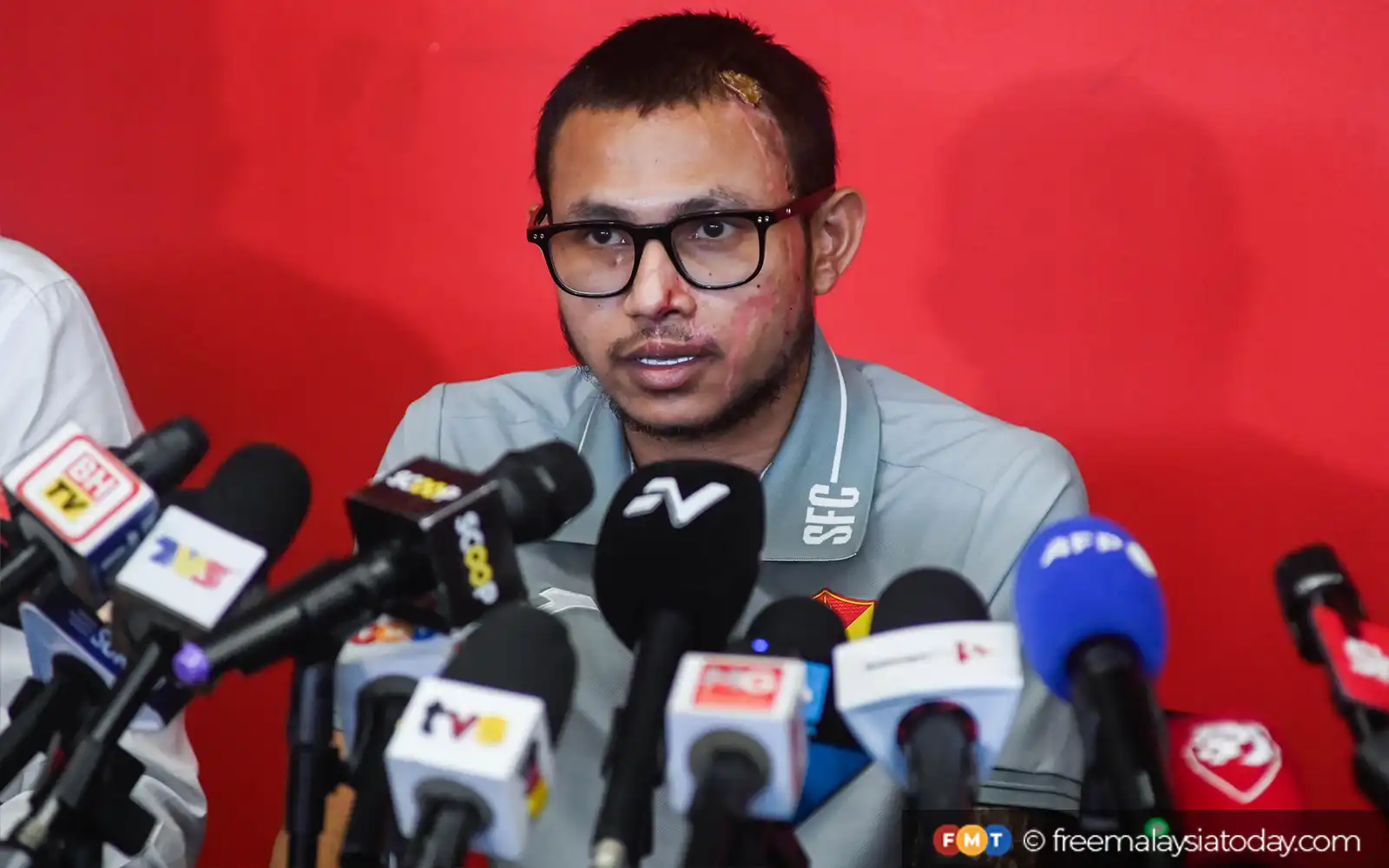 Faisal Halim’s acid attack case classified as NFA, says lawyer | FMT