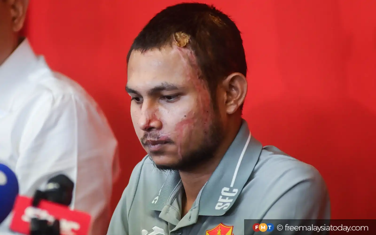 Kes Faisal disimbah asid: Kertas siasatan sudah dirujuk ke AGC | FMT