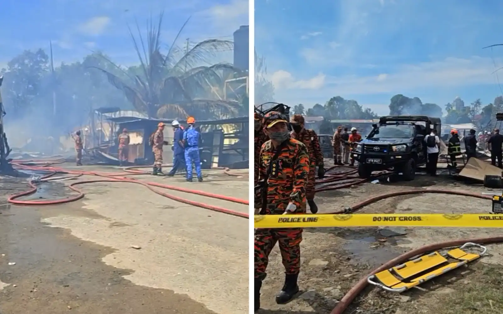 5 rentung setinggan terbakar | FMT