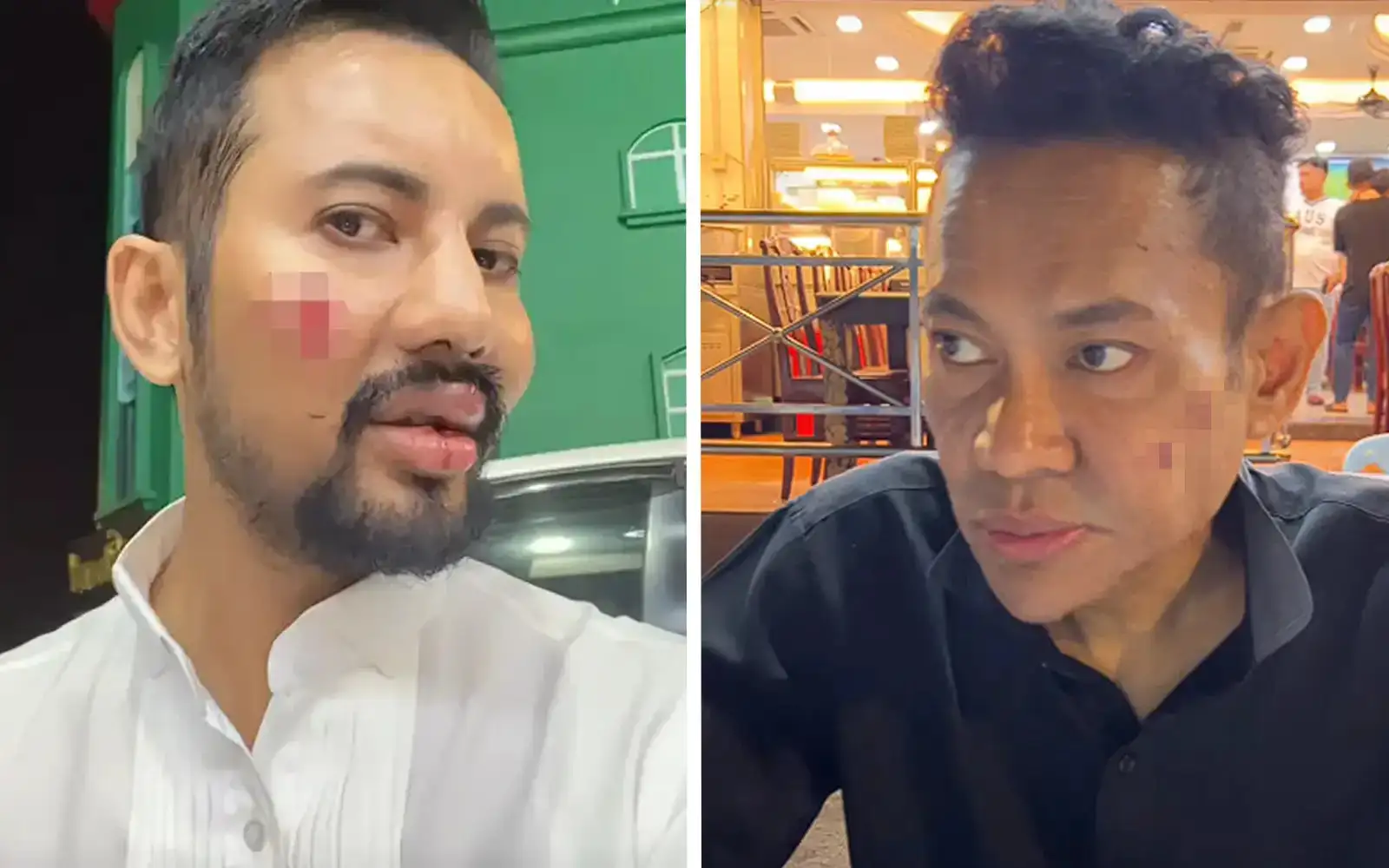 Photographer claims trial to assaulting fashion duo with camera | FMT