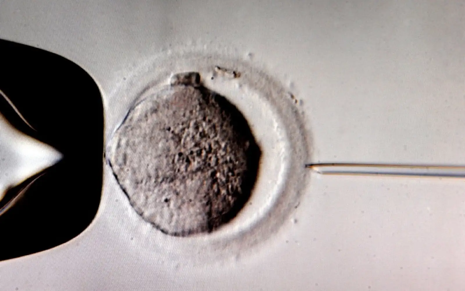 Second Australian IVF mix-up shakes clinic and industry | FMT